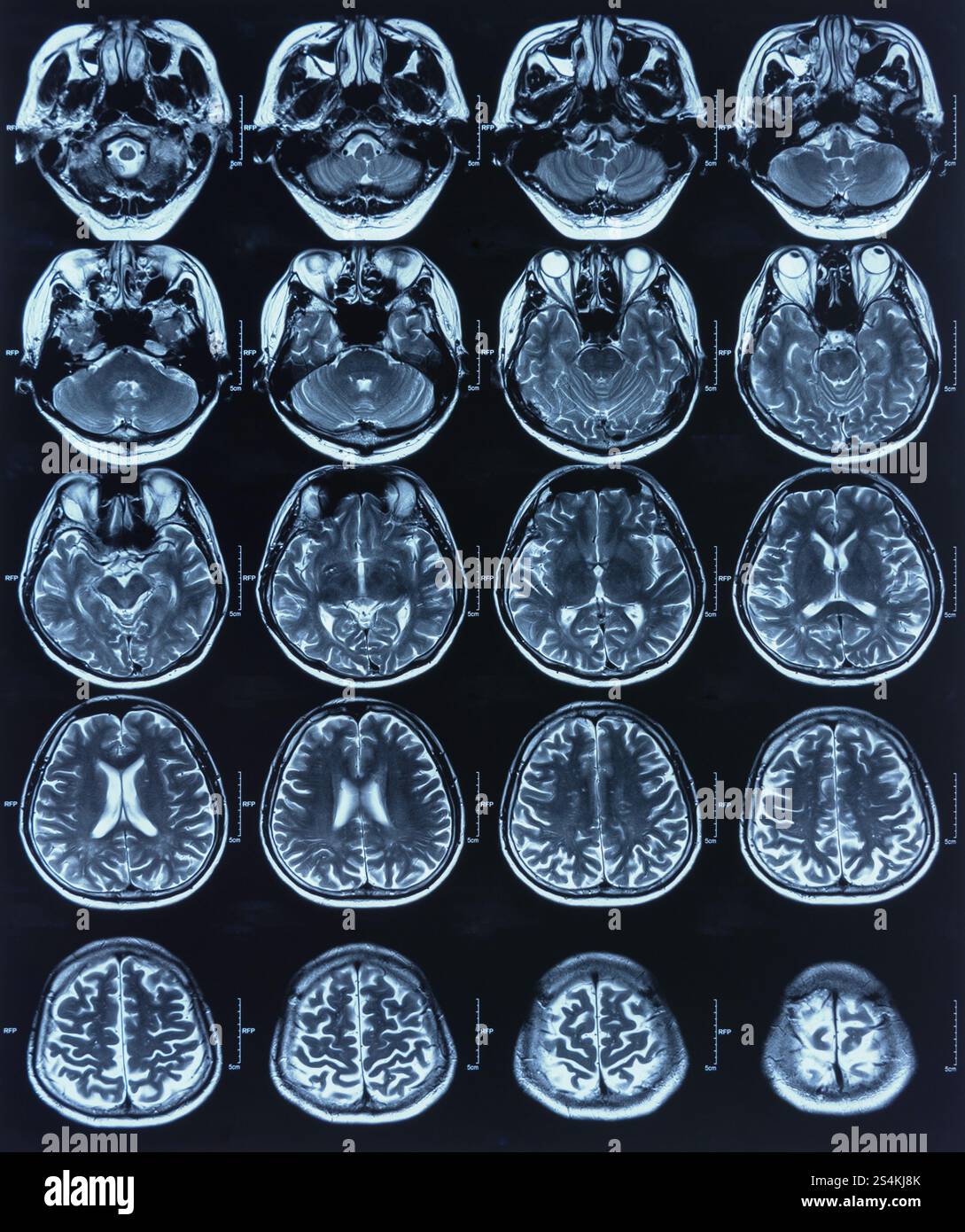 x-ray image of patient brain by computed tomography, mri for medical ...