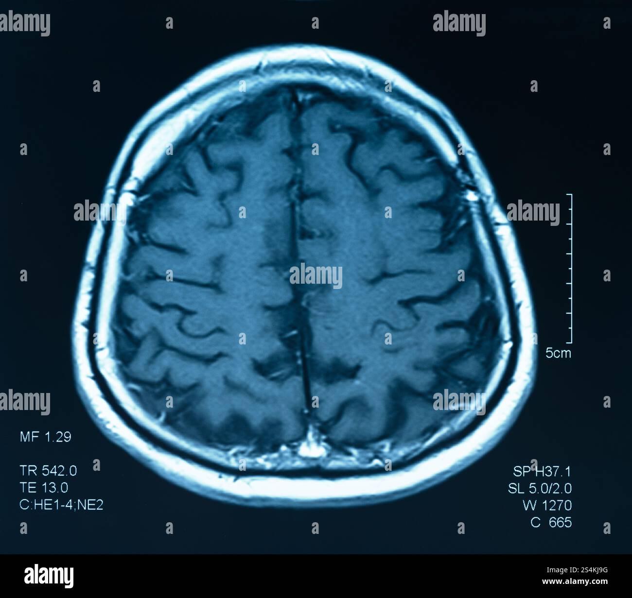 magnetic resonance image, mri scan of the brain Stock Photo - Alamy