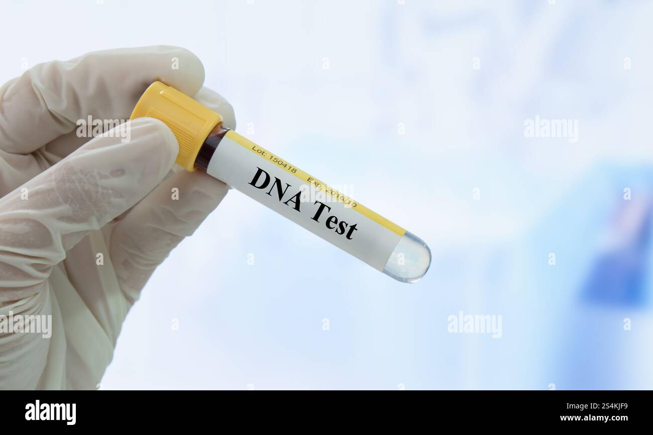 DNA test. Doctor holding sample blood collection tube for dna test in ...