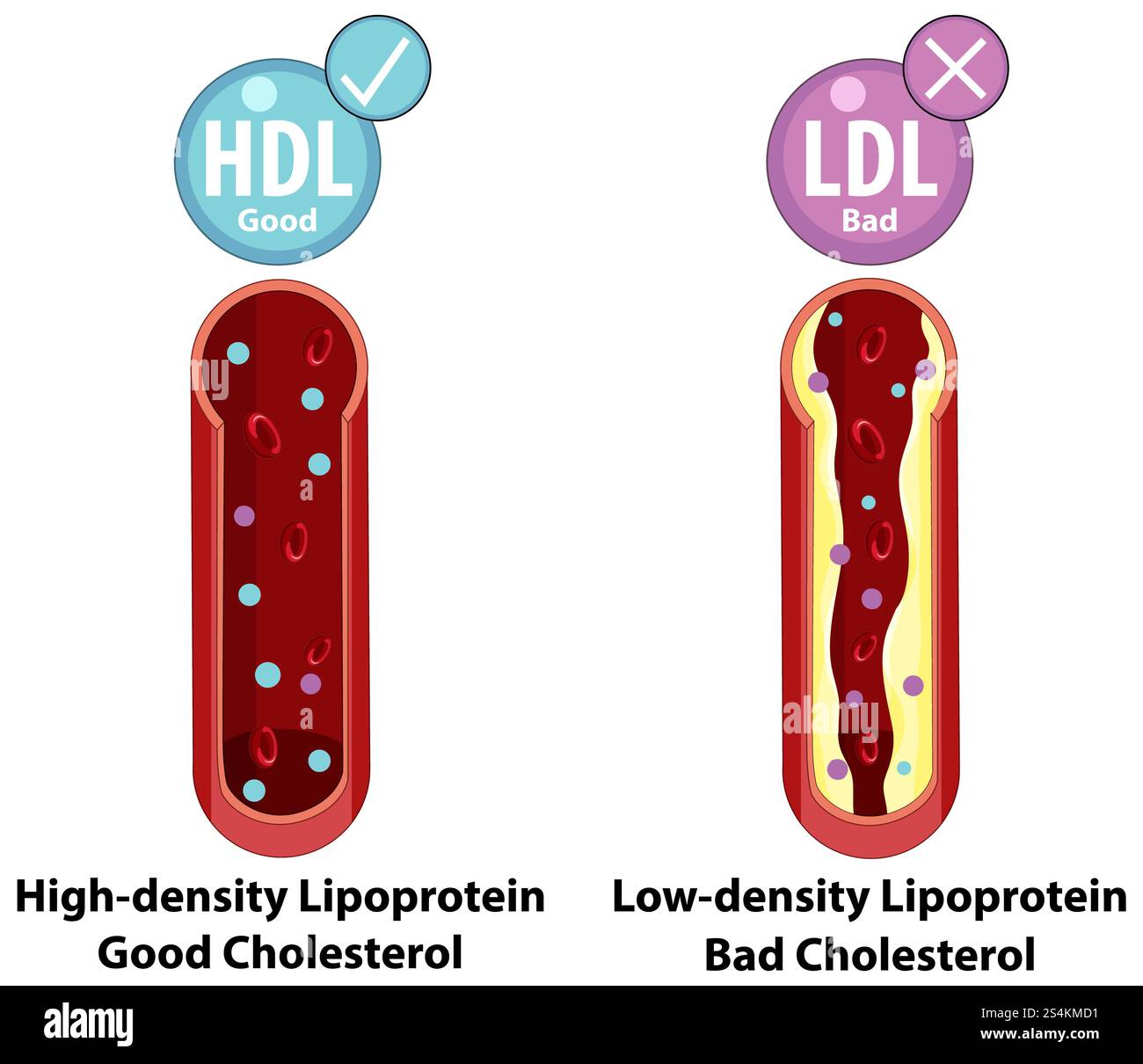 Illustration of good and bad cholesterol types Stock Photo - Alamy