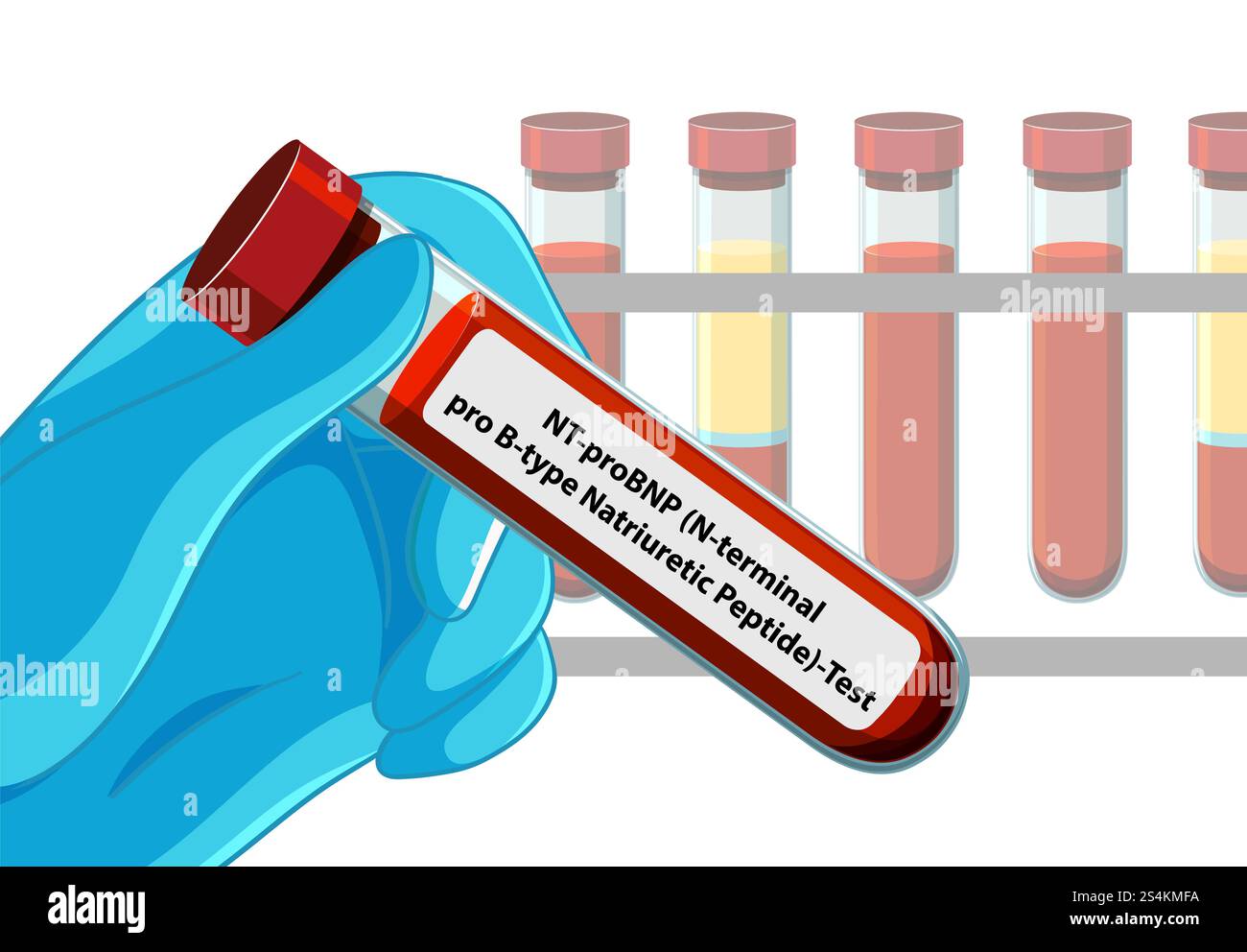 Gloved hand holding a labeled blood sample Stock Photo - Alamy