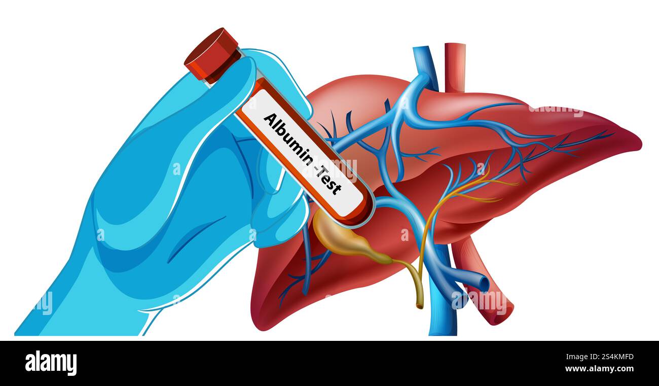 Illustration of albumin test for liver function Stock Photo - Alamy