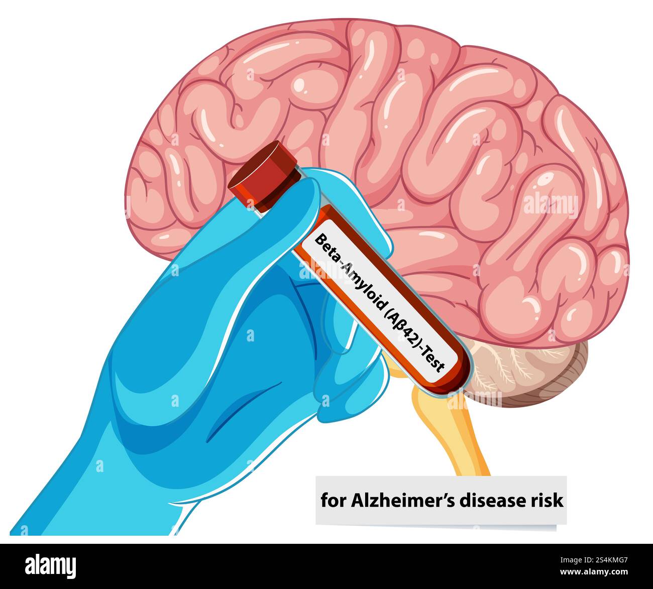 Illustration of brain and beta-amyloid test tube Stock Photo - Alamy
