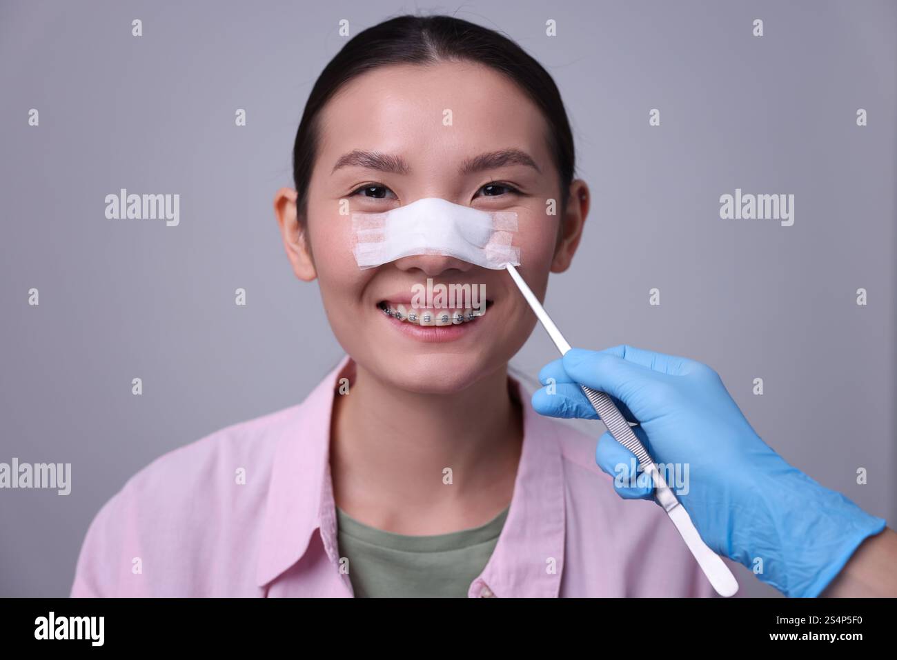 Doctor removing medical bandage from patient's nose after plastic surgery operation on light ...