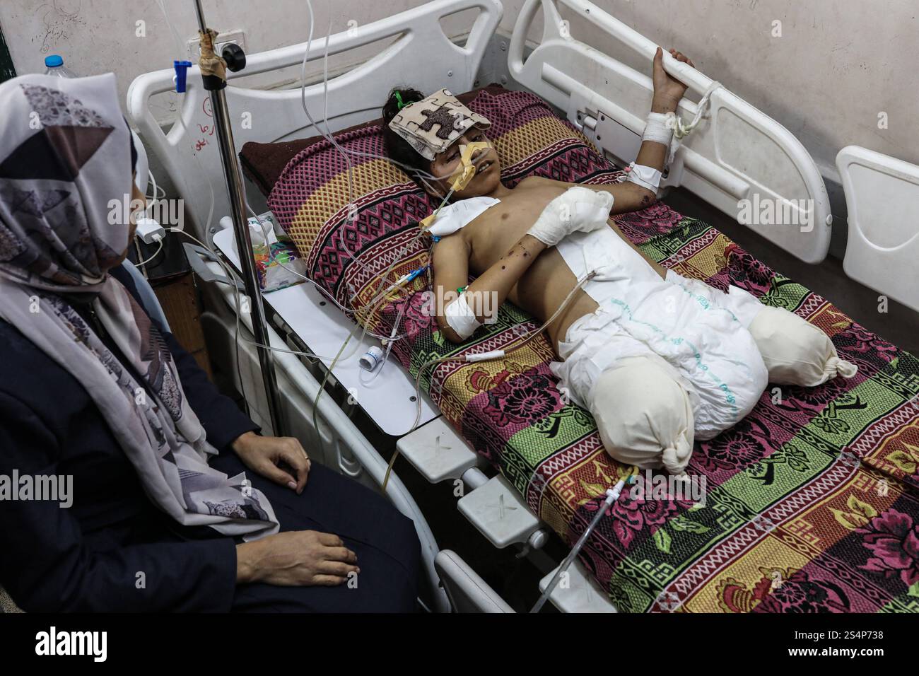 Palestinian girl Saba Abu Abeda, 13, receives medical care at Al-Aqsa ...
