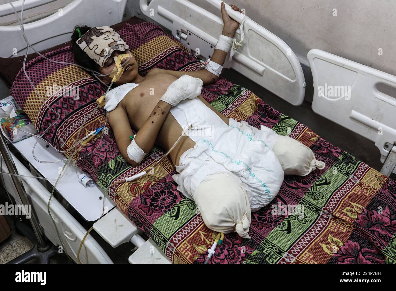 Palestinian girl Saba Abu Abeda, 13, receives medical care at Al-Aqsa ...