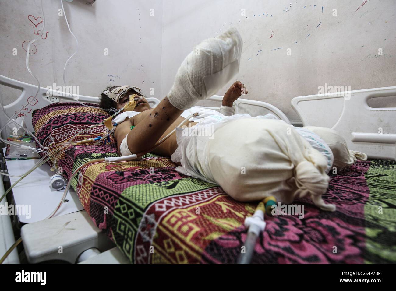 Palestinian girl Saba Abu Abeda, 13, receives medical care at Al-Aqsa ...