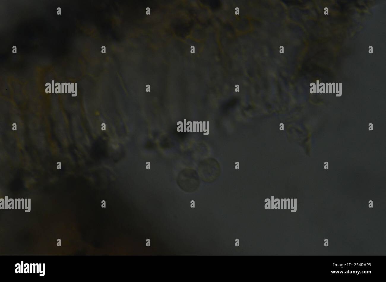 spidery mossear (Rimbachia arachnoidea Stock Photo - Alamy