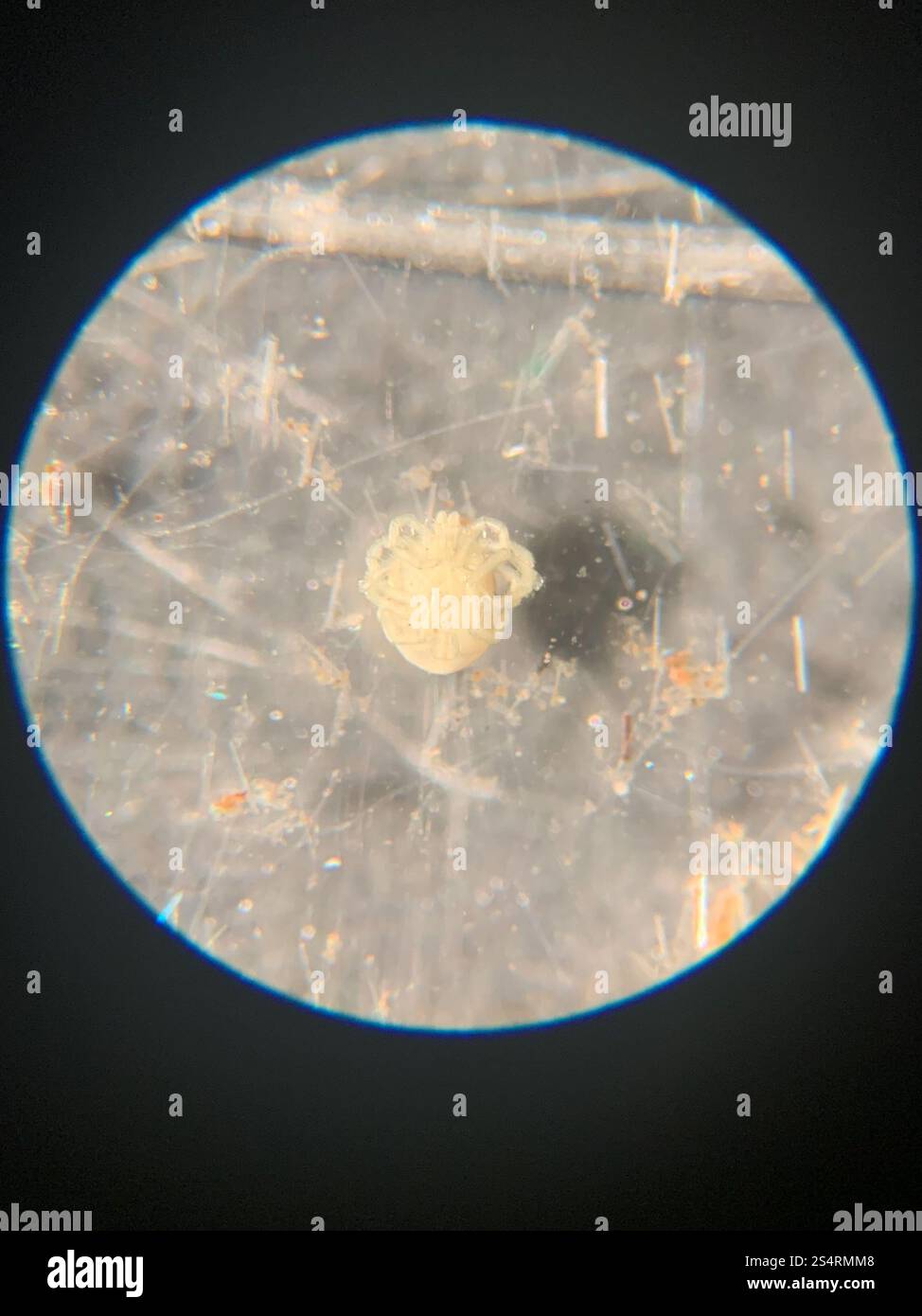 Water Mites (Hydrachnidia Stock Photo - Alamy