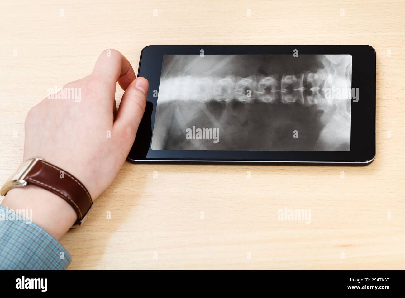 scientist analyzes X-ray picture of vertebral column on screen on ...