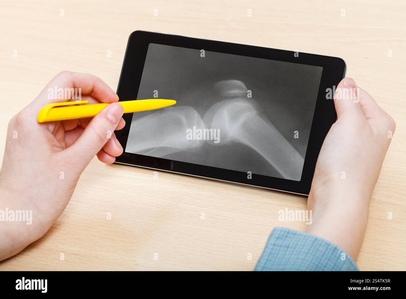 student analyzes X-ray picture of human knee-joint on screen on tablet ...
