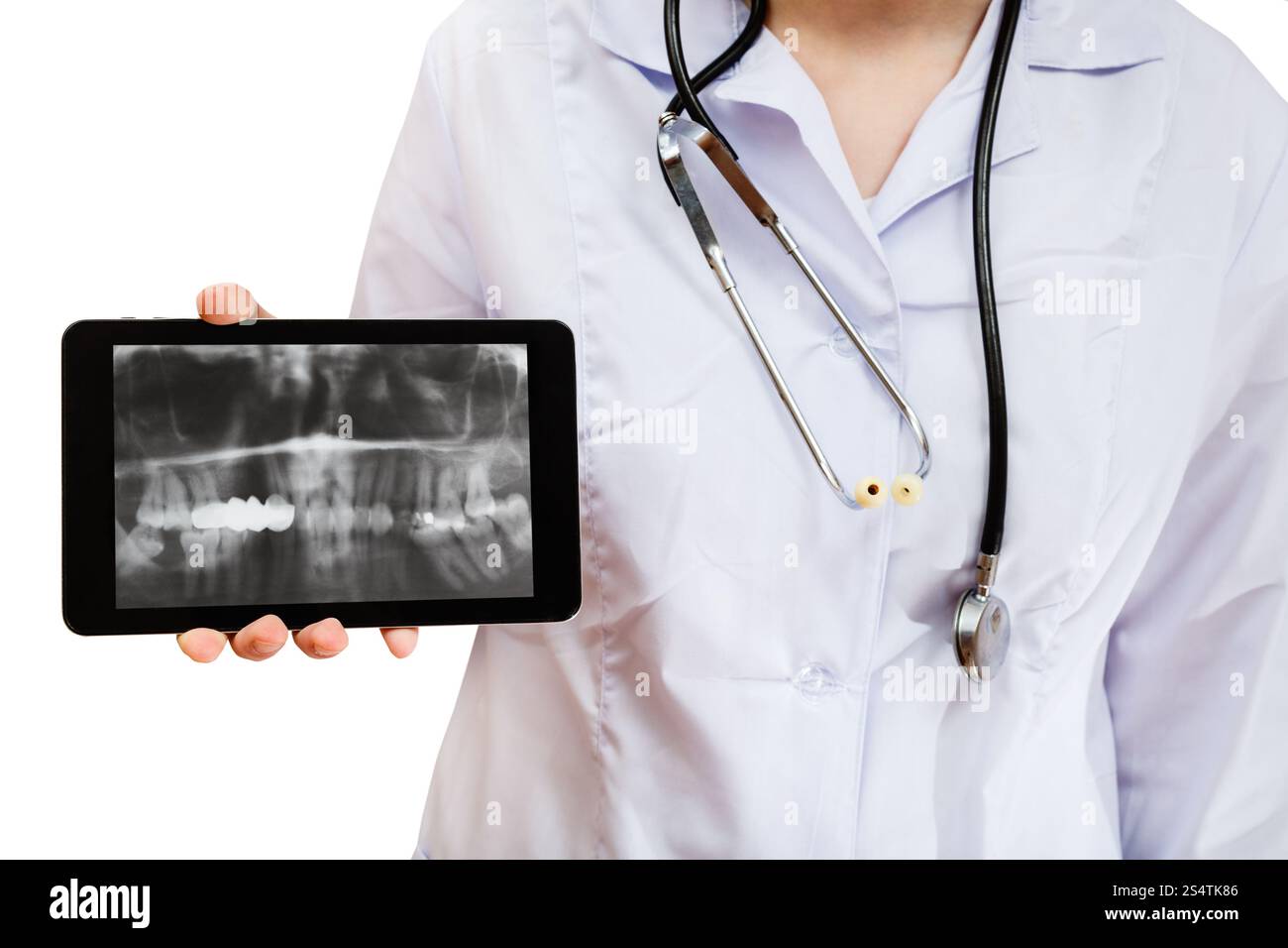 nurse holds tablet pc with dental X-ray picture of human jaws on screen ...