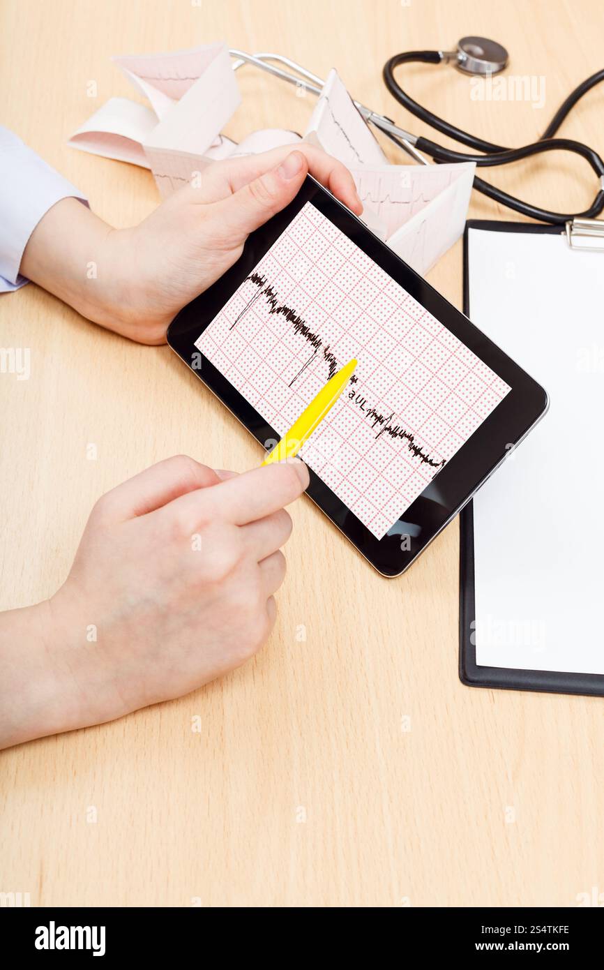 Nurse doctor checks ekg monitor hi-res stock photography and images - Alamy