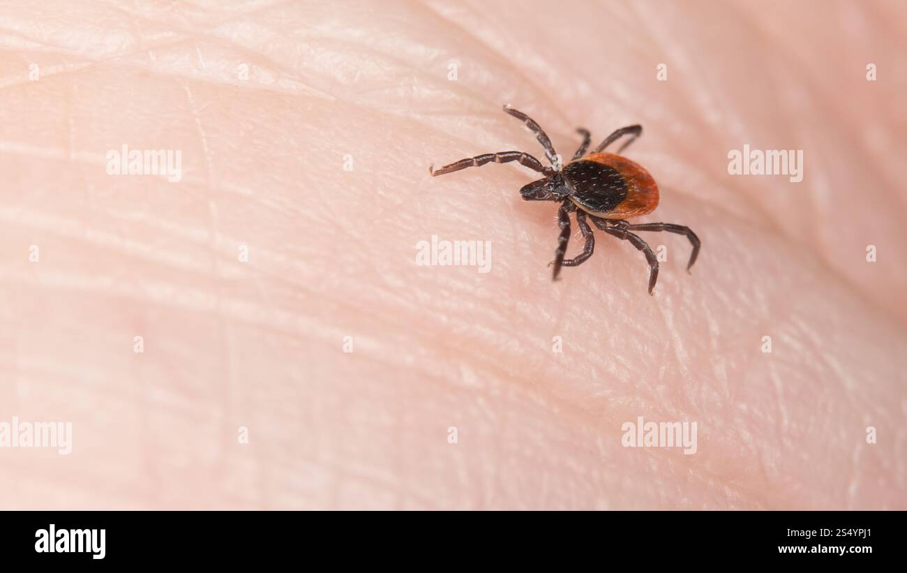 Dangerous deer tick parasite on human skin background. Disgusting ...