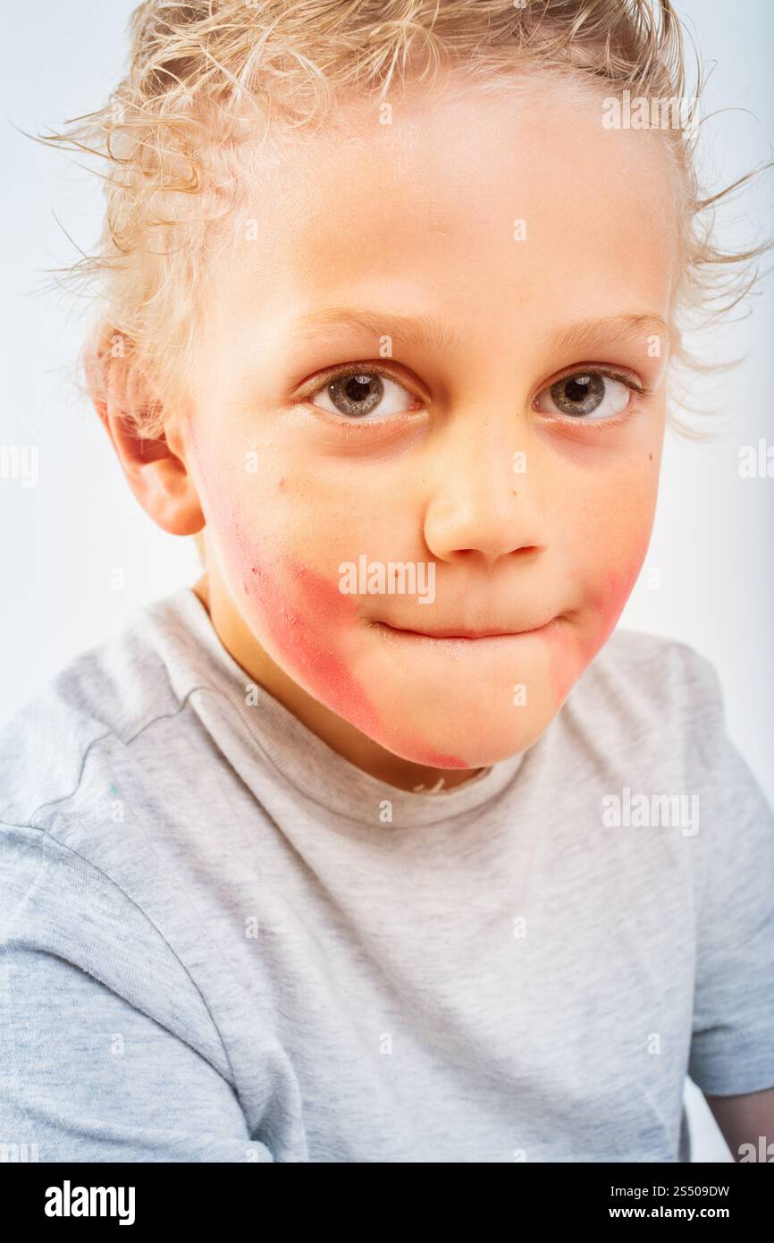 Close-up portrait of a blond child with flushed red cheeks and chin ...