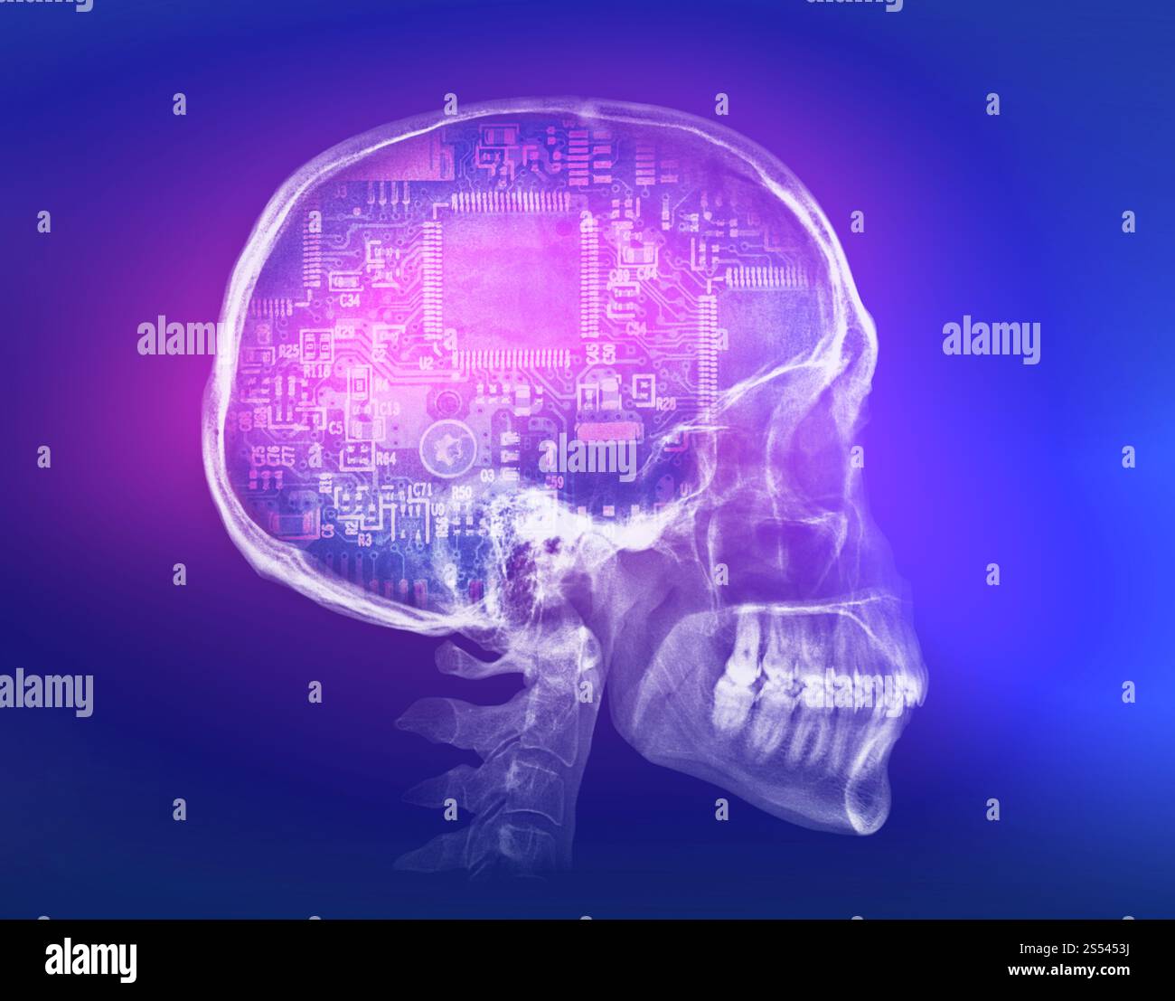Human skull X-ray image. Artificial intelligence futuristic concept ...