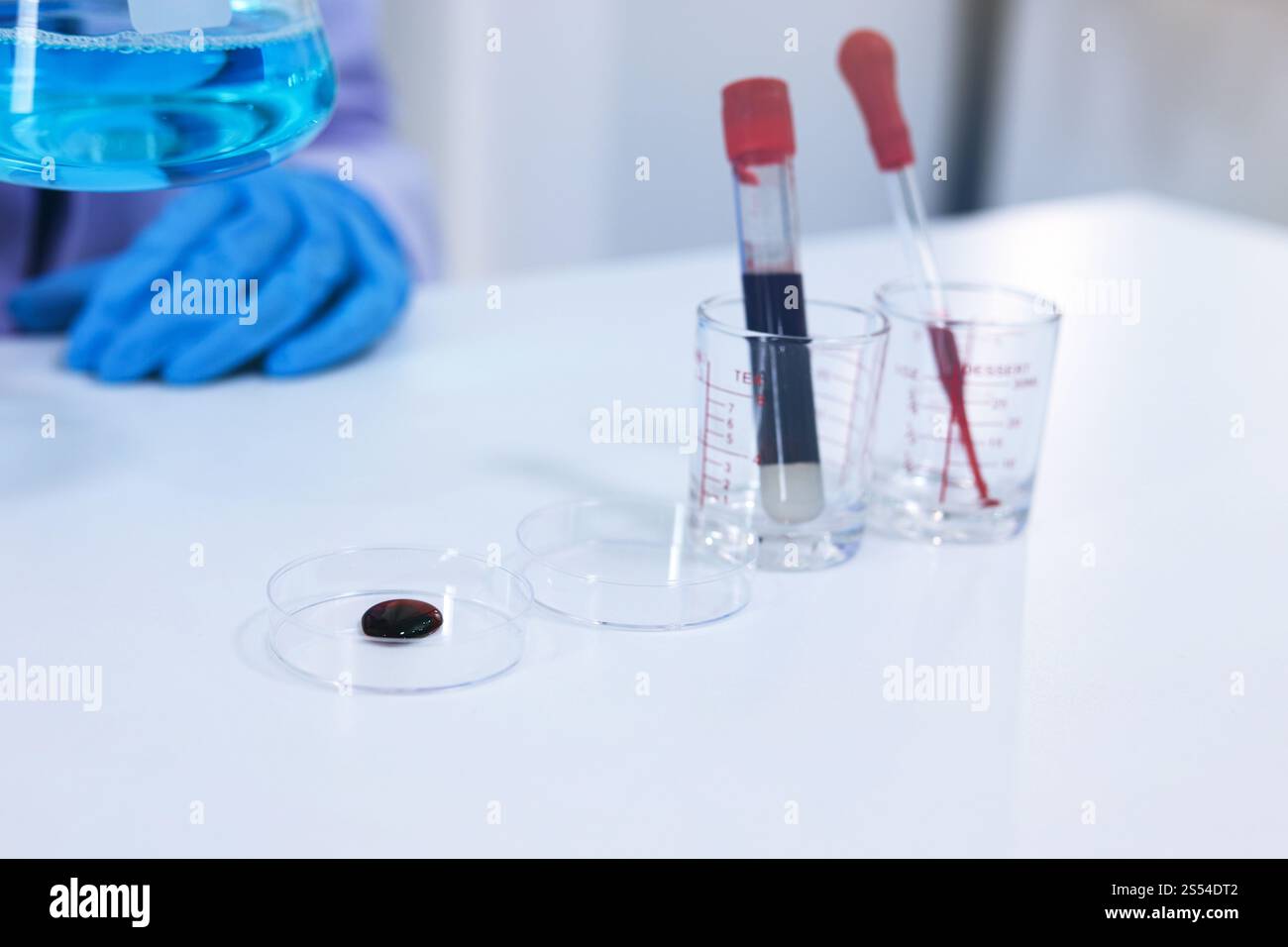 Scientist holding Coronavirus covid-19 infected blood sample tube. DNA ...