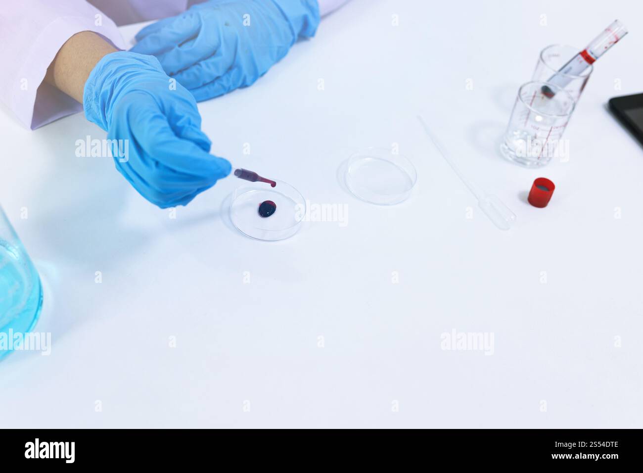 Scientist holding Coronavirus covid-19 infected blood sample tube. DNA ...