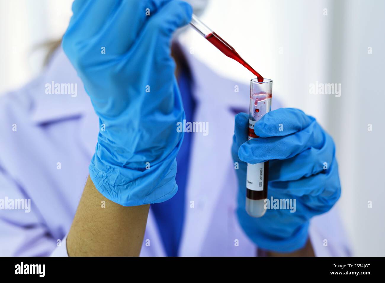 Scientist holding Coronavirus covid-19 infected blood sample tube. DNA ...