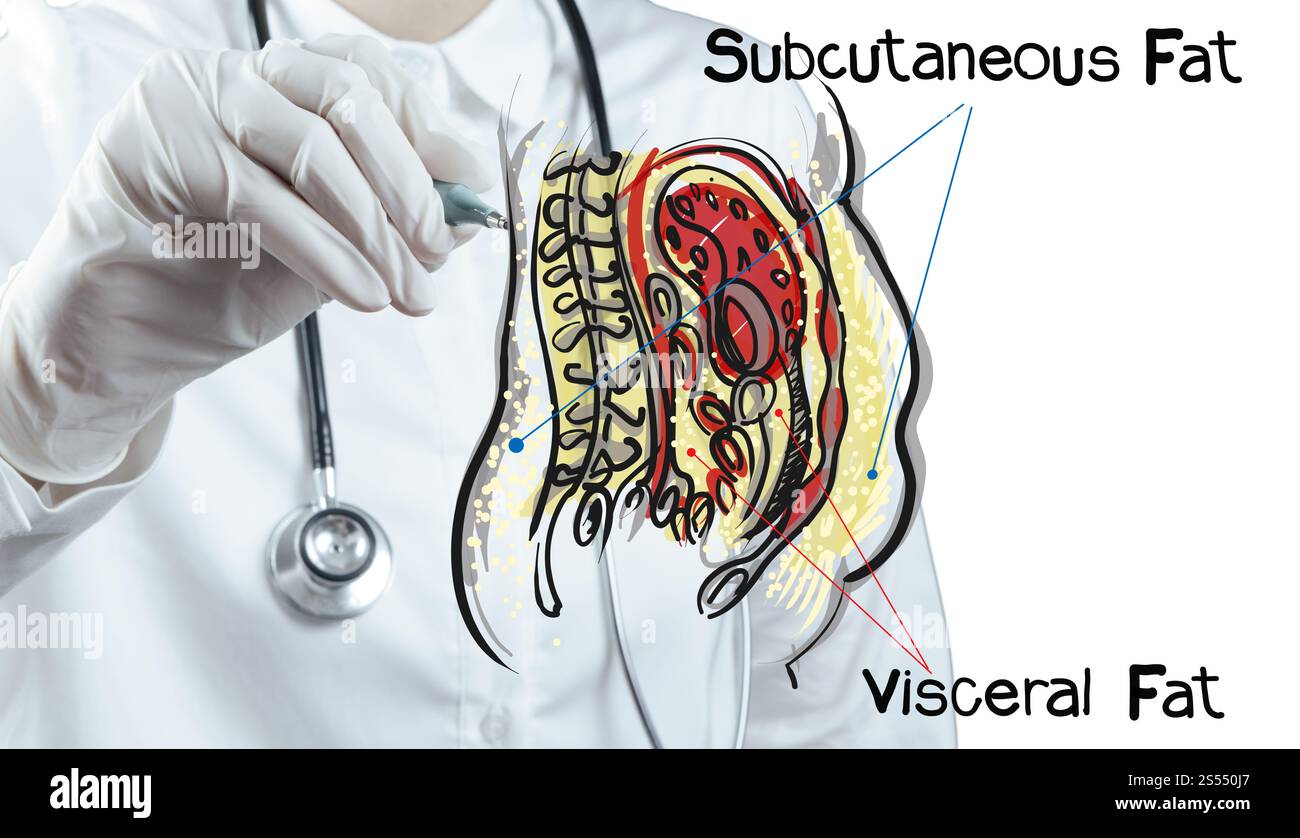 doctor draws abdominal fat as medical concept Stock Photo - Alamy
