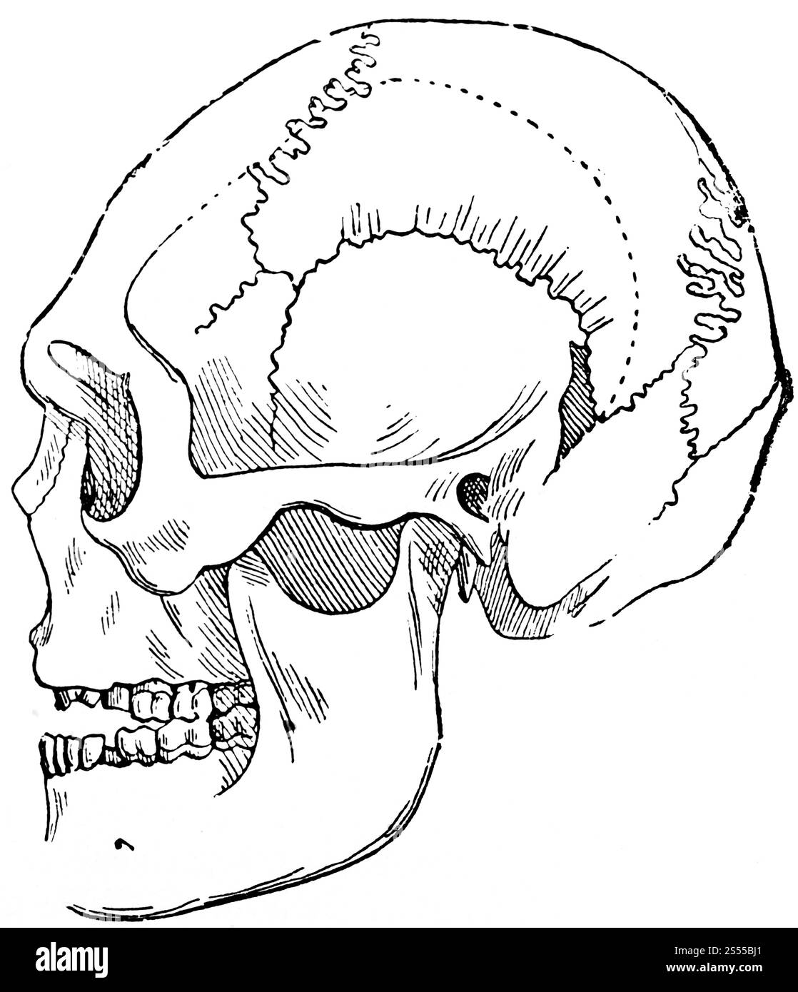 Side view of the skull from Borreby on Funen, teeth, eye socket, nose ...