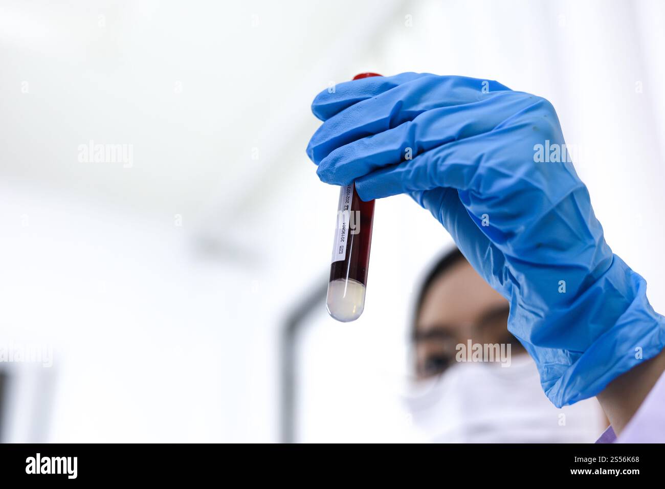 Scientist holding Coronavirus covid-19 infected blood sample tube. DNA ...