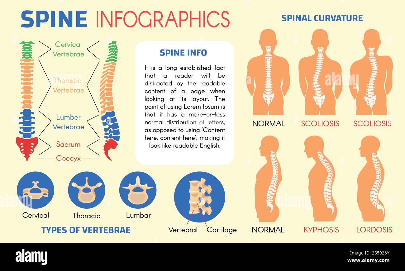 Human spine infographic. Flat illustration of human spine vector infographic for web design ...
