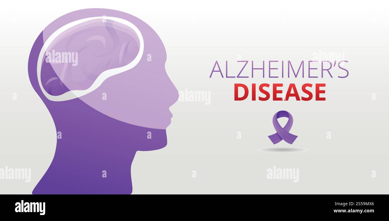 Modern alzheimer disease concept banner. Cartoon illustration of modern ...