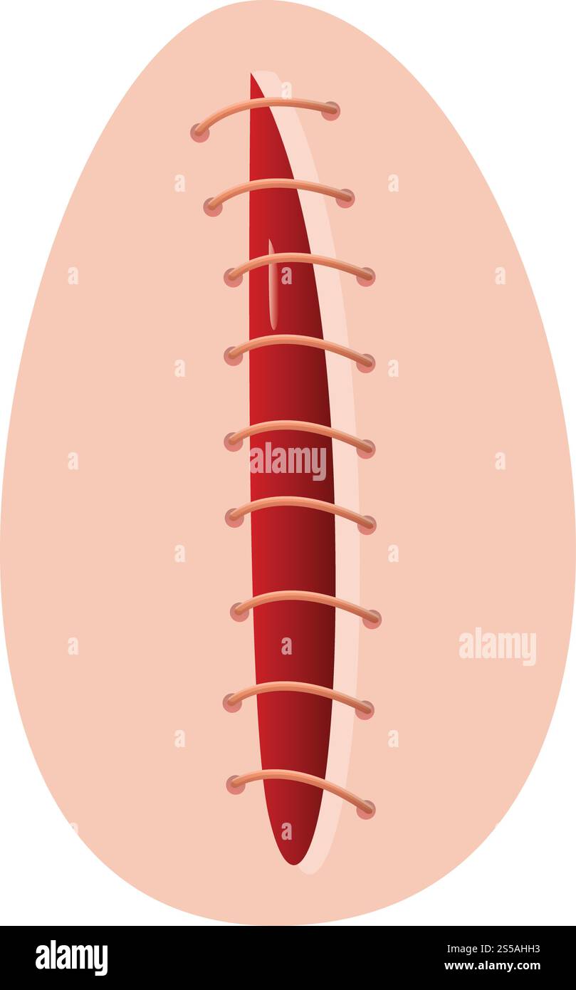 Doctor suture icon. Cartoon of doctor suture vector icon for web design ...