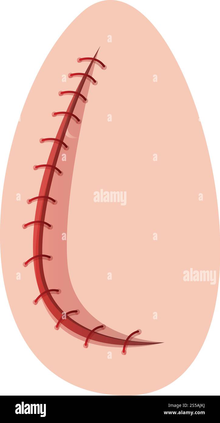 Laceration suture icon. Cartoon of laceration suture vector icon for ...