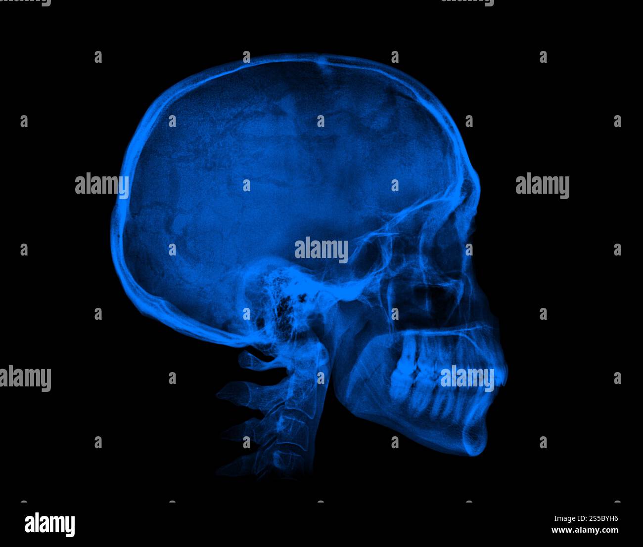 Human skull. Blue X-ray image isolated on black background. Human skull ...