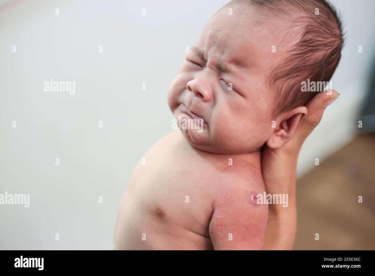 Newborn baby with red spots due to injection Stock Photo - Alamy