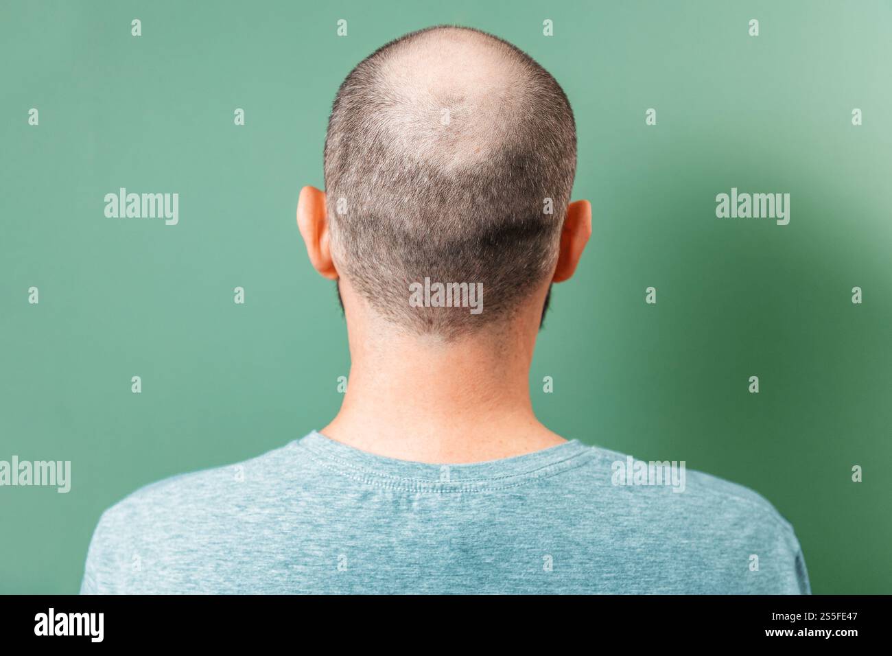 Back view of baldness man. Rear view. Green background. Copy space. The ...