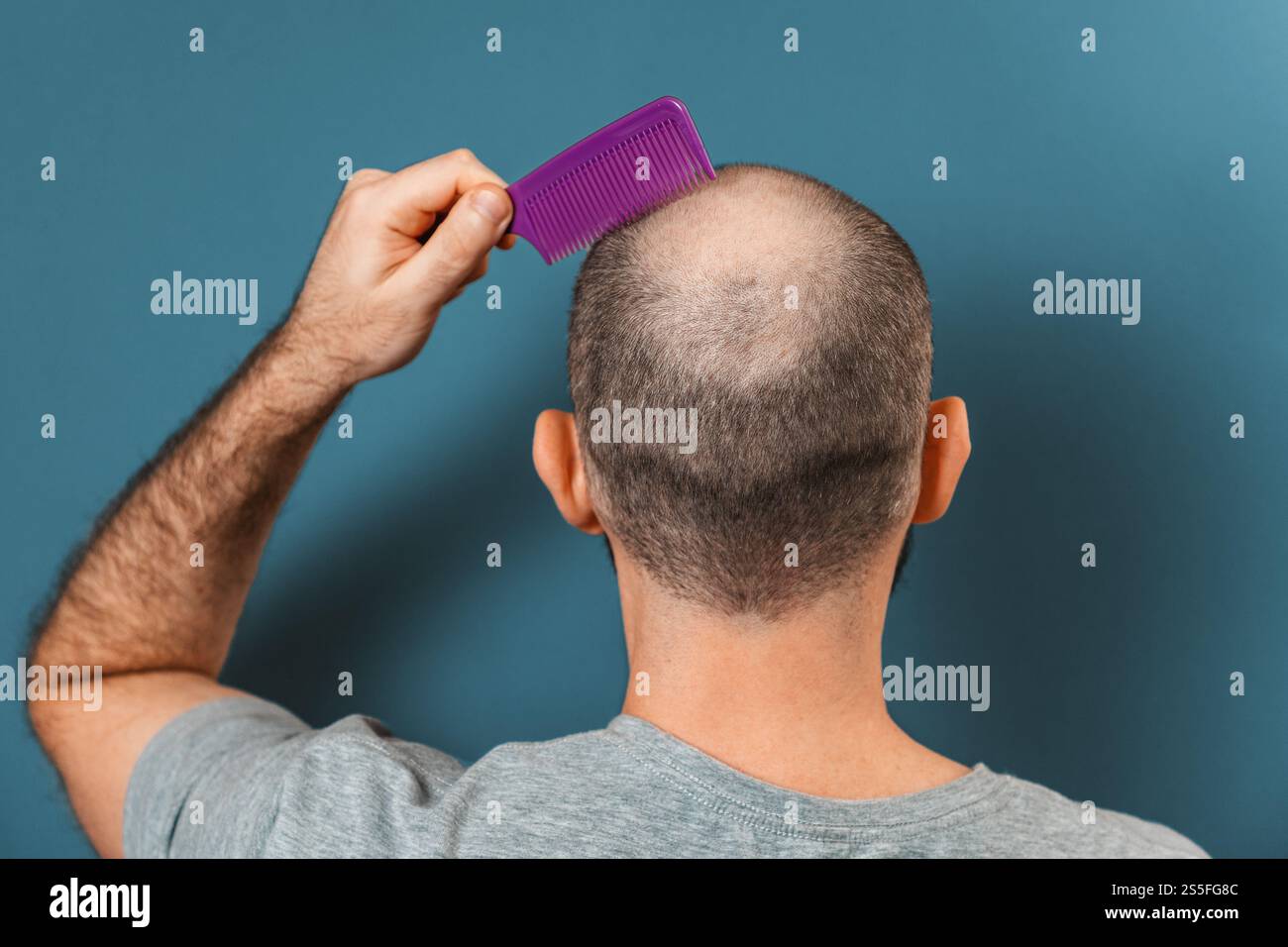 A man combs his bald head with a comb. Blue background. Rear view. The ...