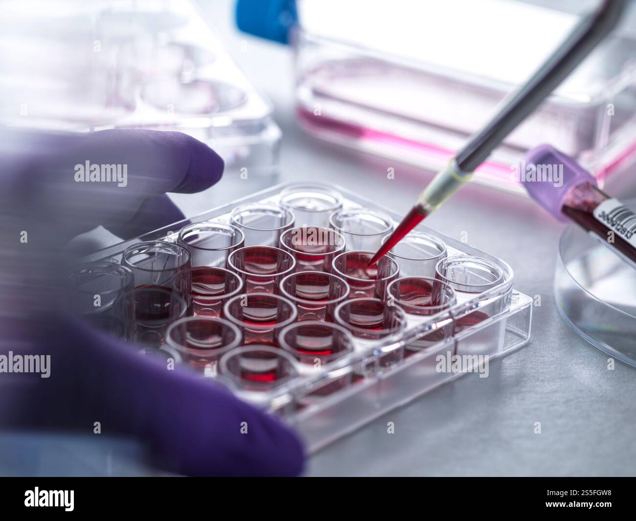 Cell Research, Scientist pipetting blood for cell research during a ...