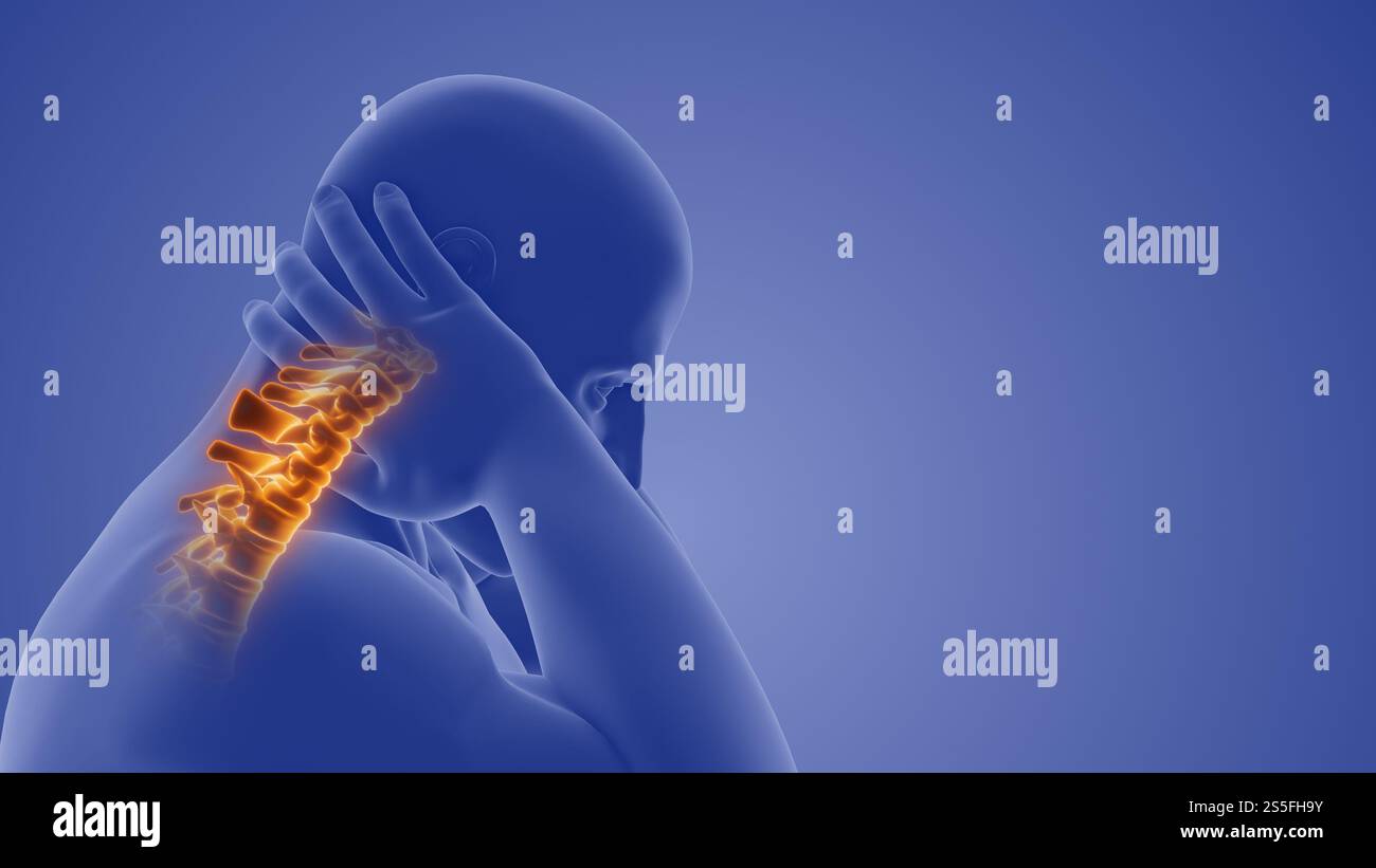 Neck Discomfort Caused by Poor Cervical Posture Stock Photo - Alamy