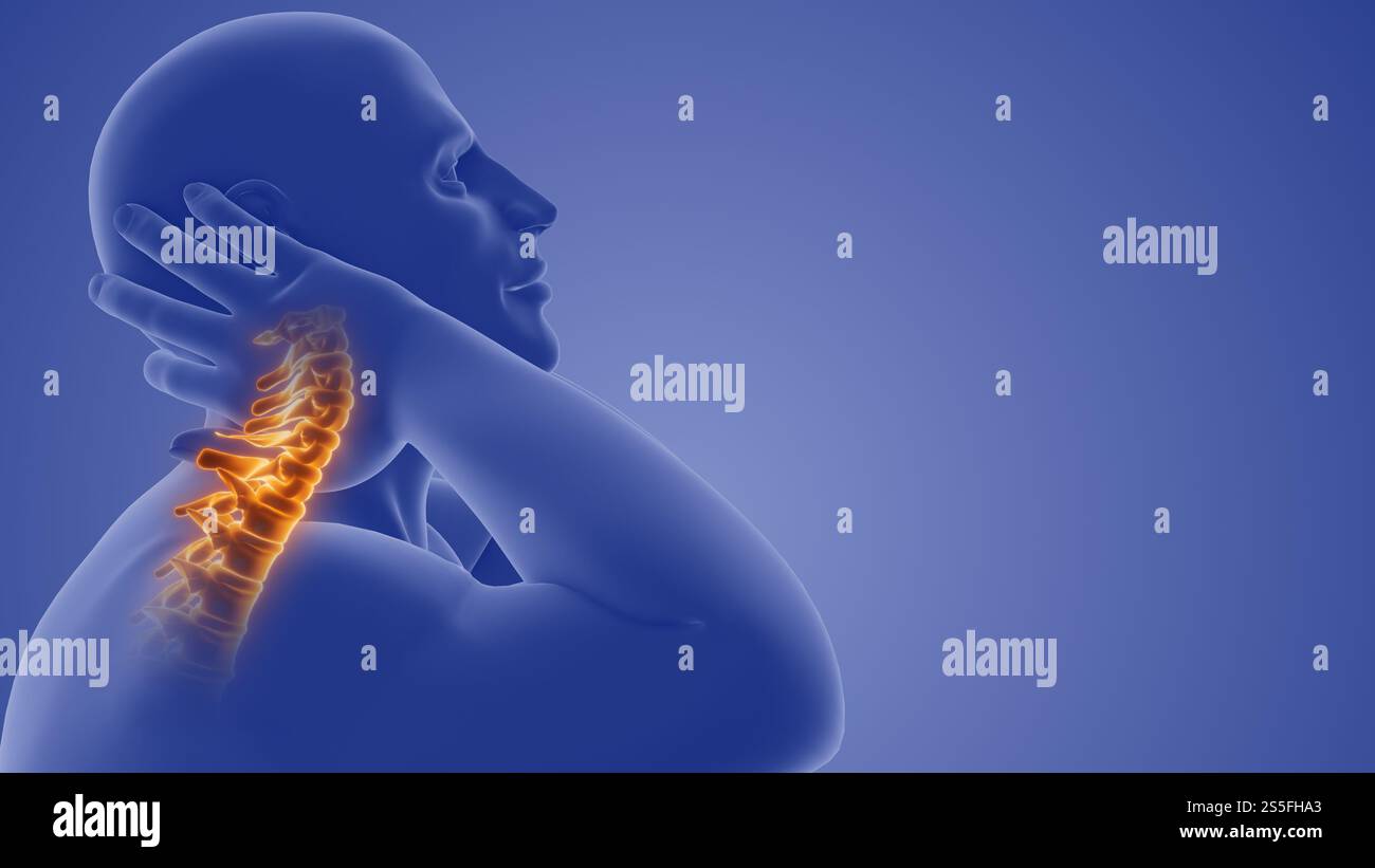 Neck Discomfort Caused by Poor Cervical Posture Stock Photo - Alamy
