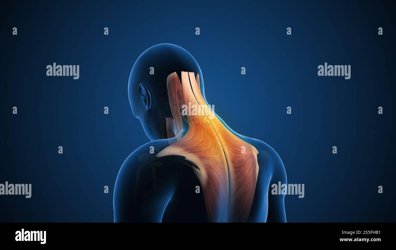 Neck Pain Associated with Cervical Posture Issues Stock Photo - Alamy