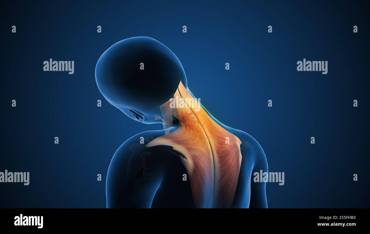 Neck Pain Associated with Cervical Posture Issues Stock Photo - Alamy