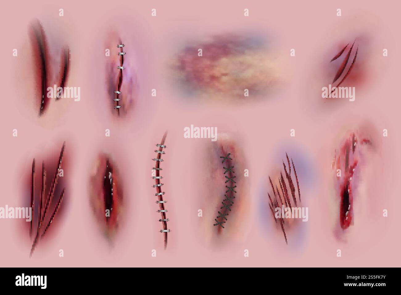 Types Of Skin Wounds