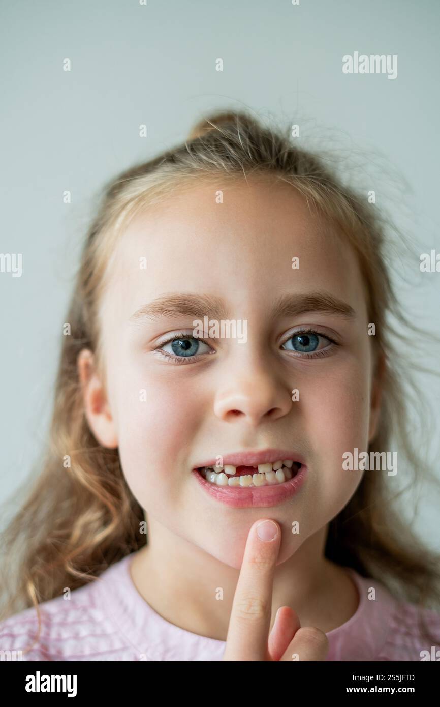 Child lost teeth. Portrait of little girl without teeth. Home Stock ...