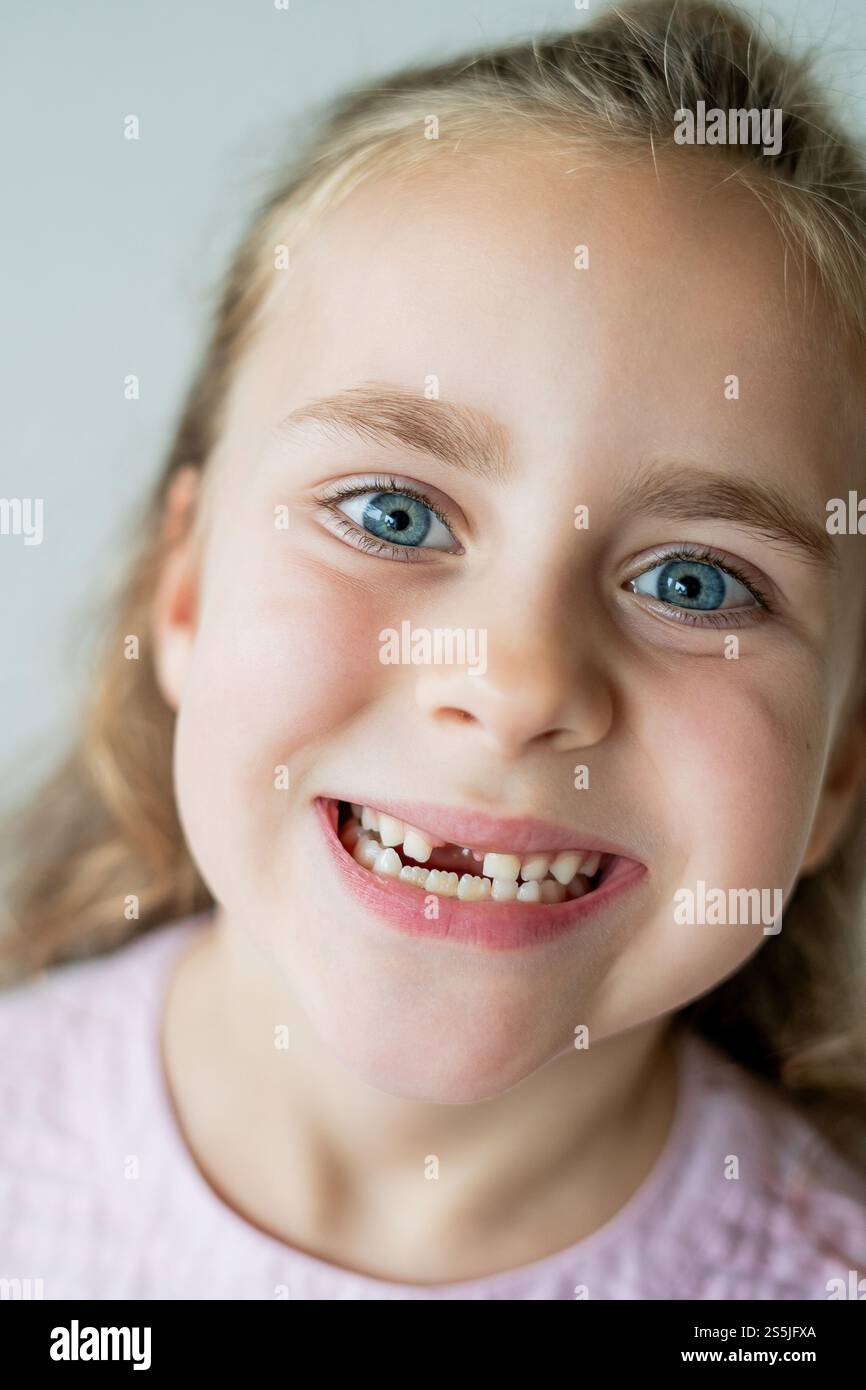 Child lost teeth. Portrait of little girl without teeth. Home Stock ...