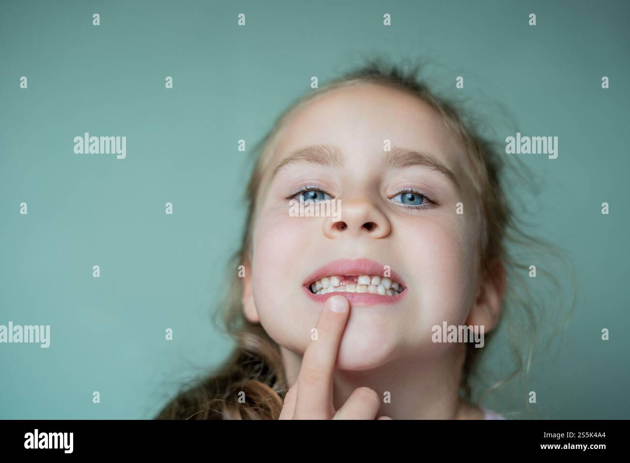 Child lost teeth. Portrait of little girl without teeth. Home Stock ...