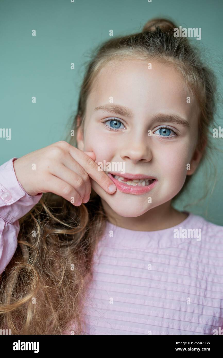 Child lost teeth. Portrait of little girl without teeth. Home Stock ...