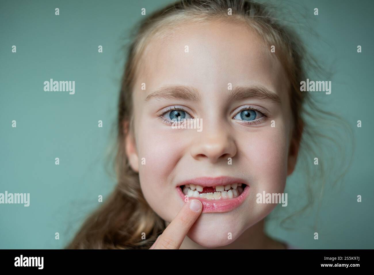 Child lost teeth. Portrait of little girl without teeth. Home Stock ...