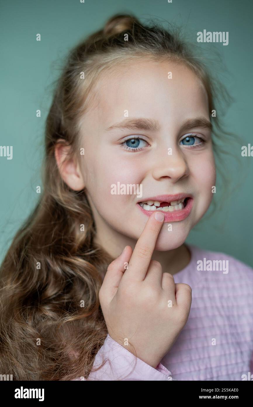Child lost teeth. Portrait of little girl without teeth. Home Stock ...