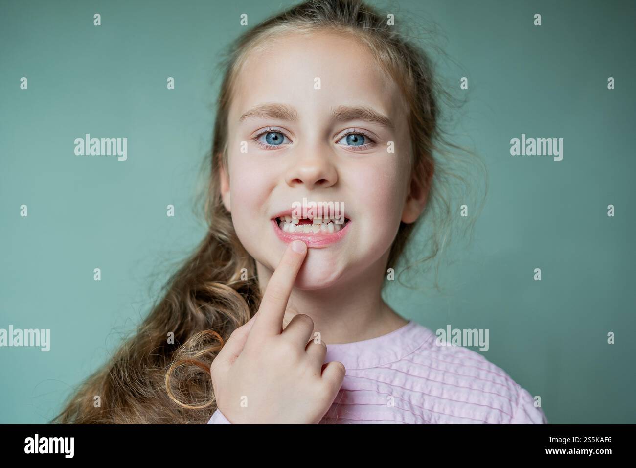 Child lost teeth. Portrait of little girl without teeth. Home Stock ...