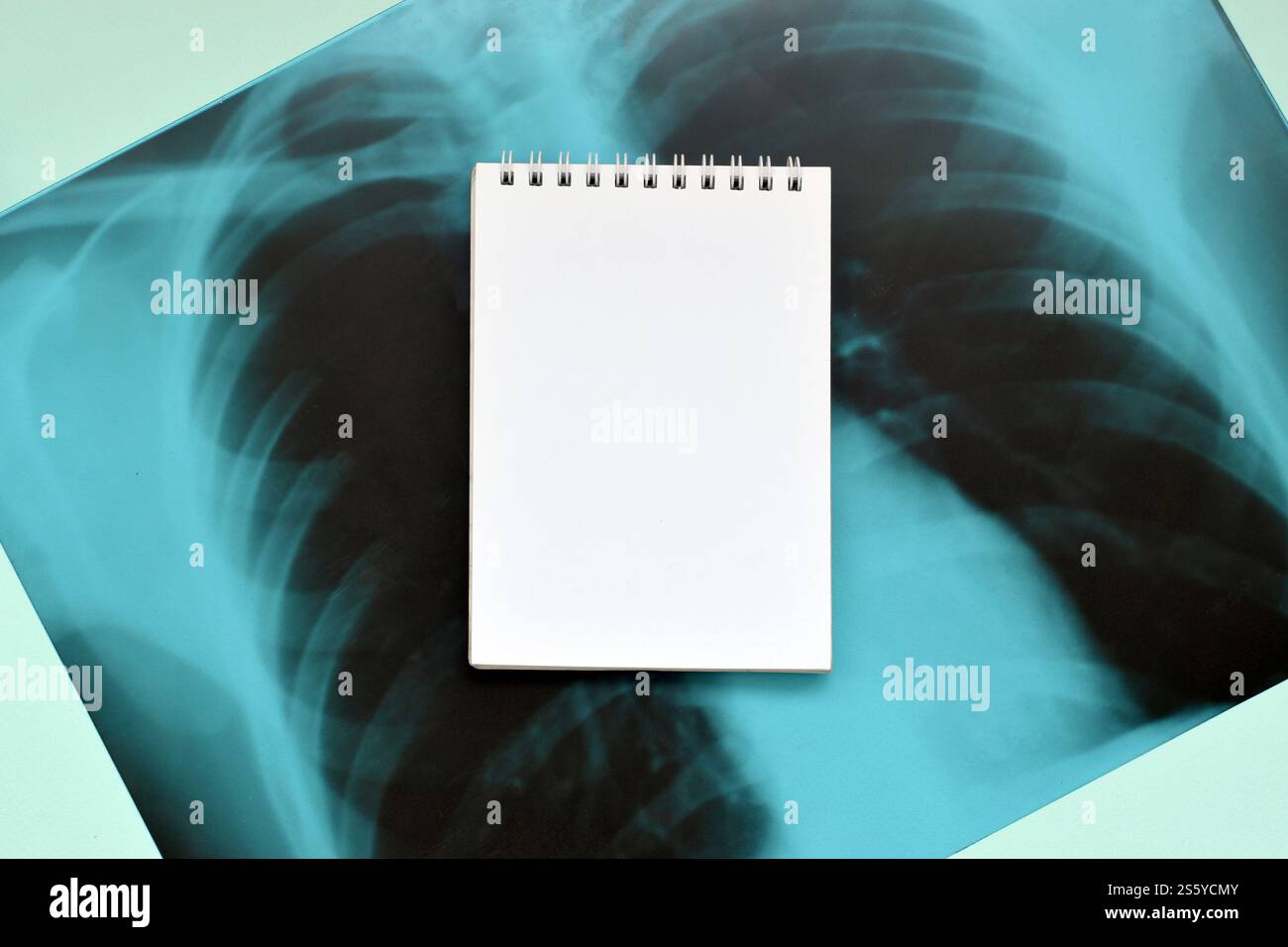 X-Ray film image of human chest for a medical diagnosis and empty blank ...