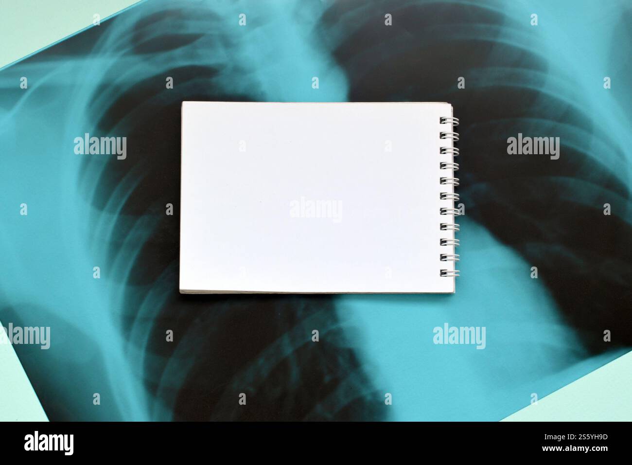 X-Ray film image of human chest for a medical diagnosis and empty blank ...