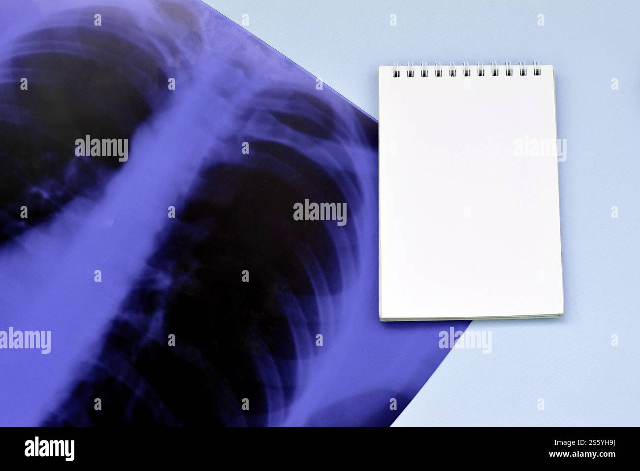 X-Ray film image of human chest for a medical diagnosis and empty blank ...